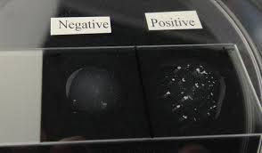 COAGULASE TEST - Microbiology Laboratory Turkey