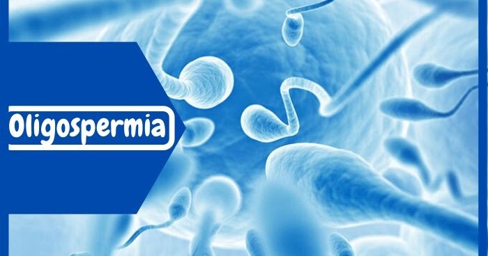 OLIGOSPERMIA: WHAT IS THE CONSIDERABLE SPERM COUNT FOR CONCEPTION?