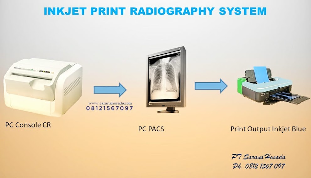INKJET PRINT RADIOGRAPHY SYSTEM - ALAT X-RAY, PAKET RADIOLOGI, KACA PB ...