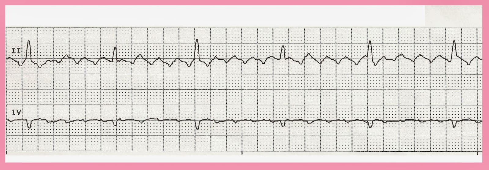 Practice EKG Rhythm Strips 209