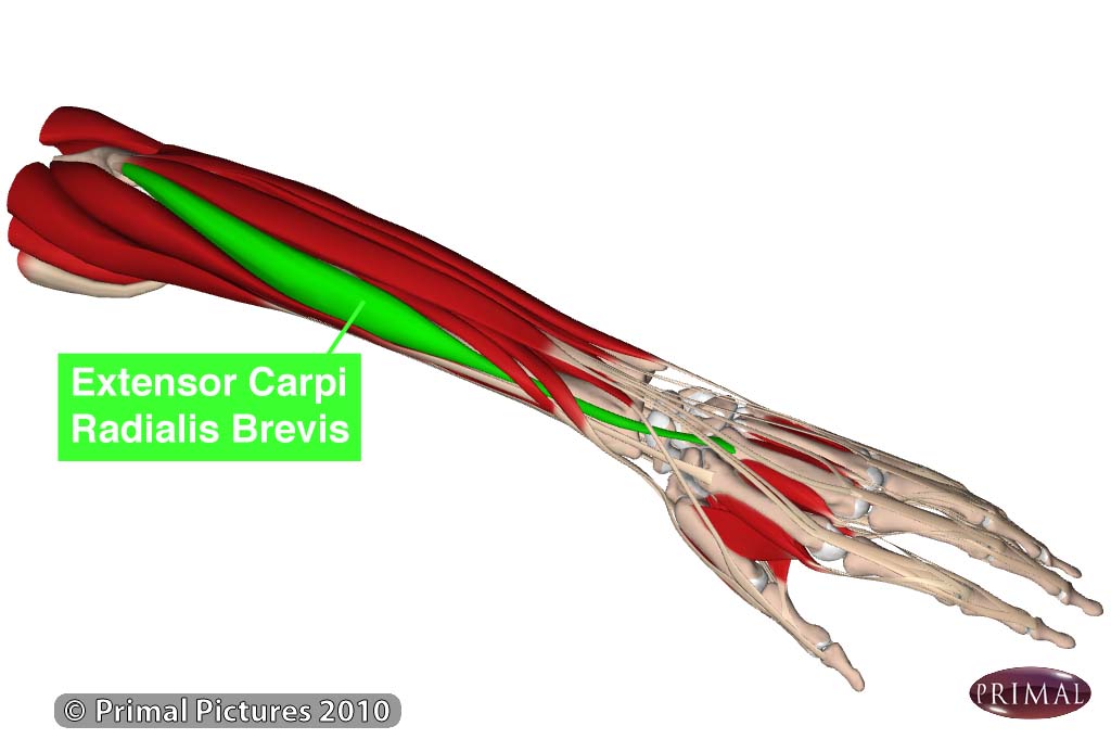 Swindons Premier Sports Injury Practitioner: Lateral Epicondylitis ...