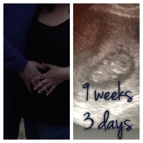 Mrs. H: 3rd Ultrasound! 9w5d