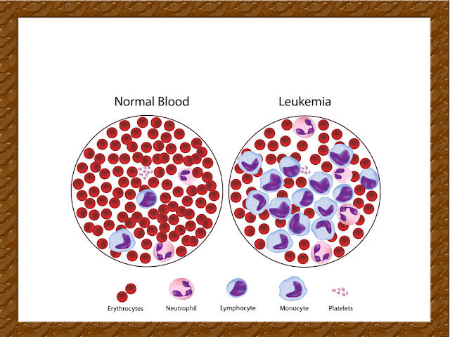 Leukemia Blood Cells PPT Template TV10115
