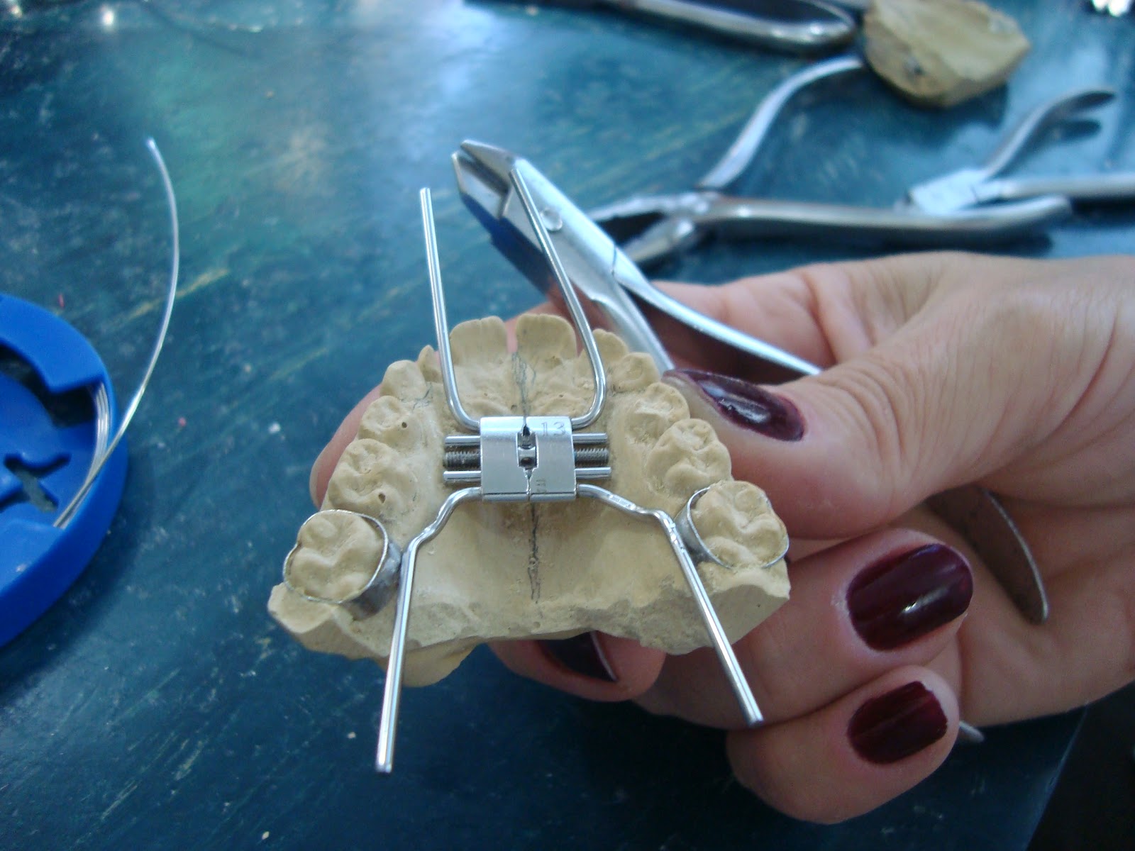 Laboratório Ortodôntico Bohrer: CONFECÇÃO DE HYRAX