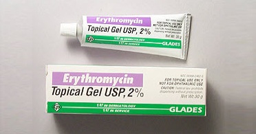 14 Filipino Inventions: Myth or Fact? - Manila Chronicles