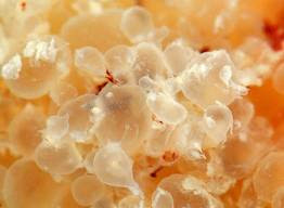 Pengertian Kehamilan anggur (mola hidatidosa) | world health