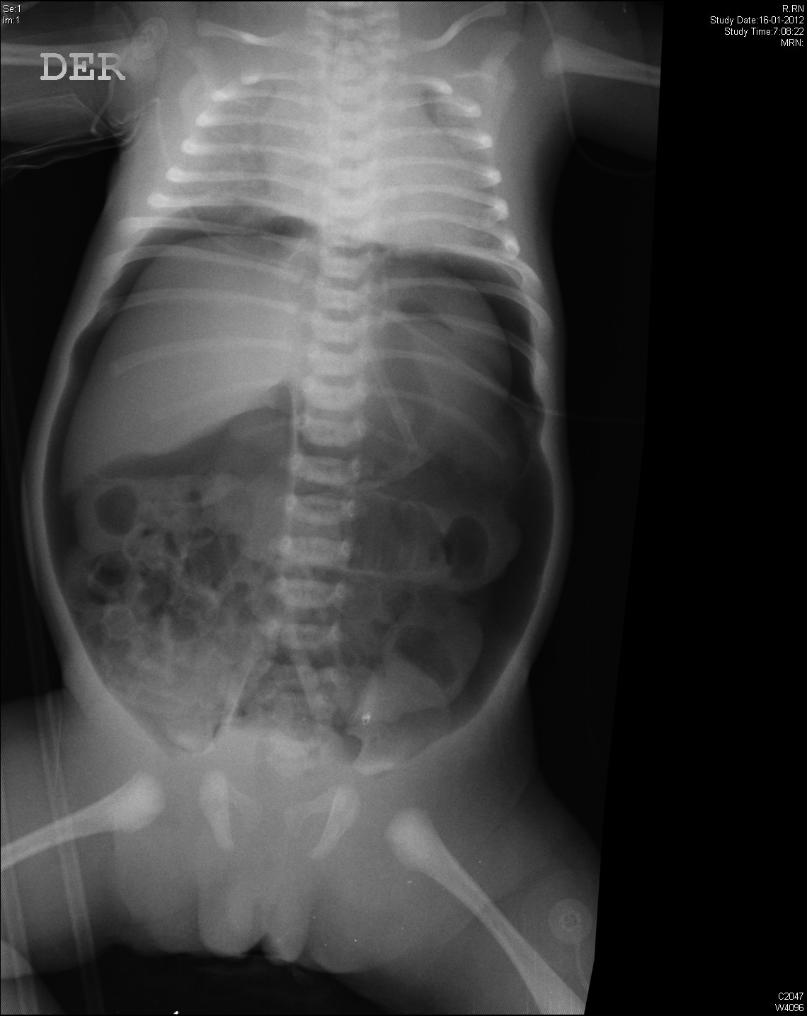 Radiografia Abdominal