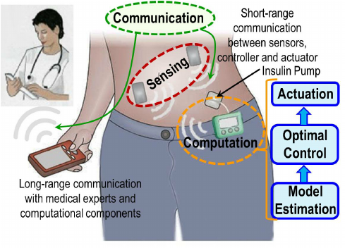 EXAMS AND ME : Artificial Pancreas