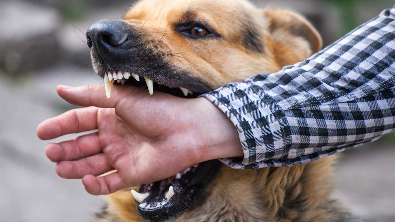 MedFriendly Medical Blog: How to Get Fully Compensated for a Dog Bite