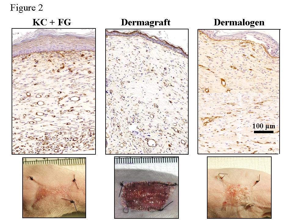 My unpublished biomedical research: Wound Neovascularization with ...