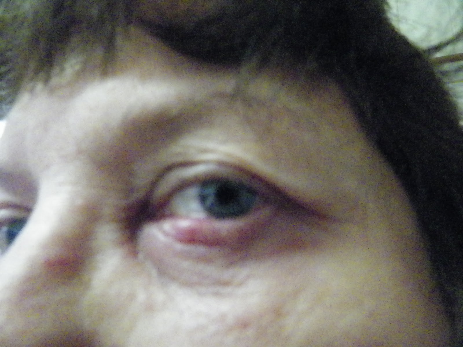 I'll Pour: Sty in your Eye