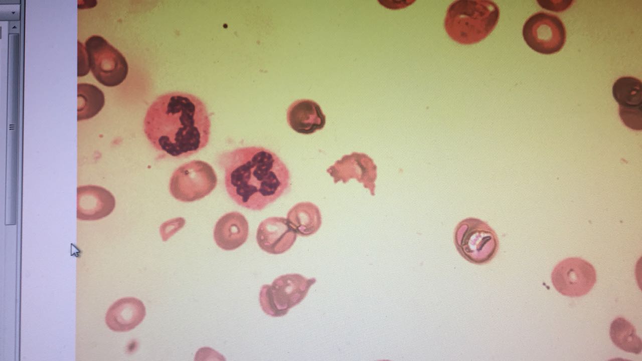 EL RINCÓN DE LA MEDICINA INTERNA. juanpedromacaluso@yahoo.com.ar: Mujer ...