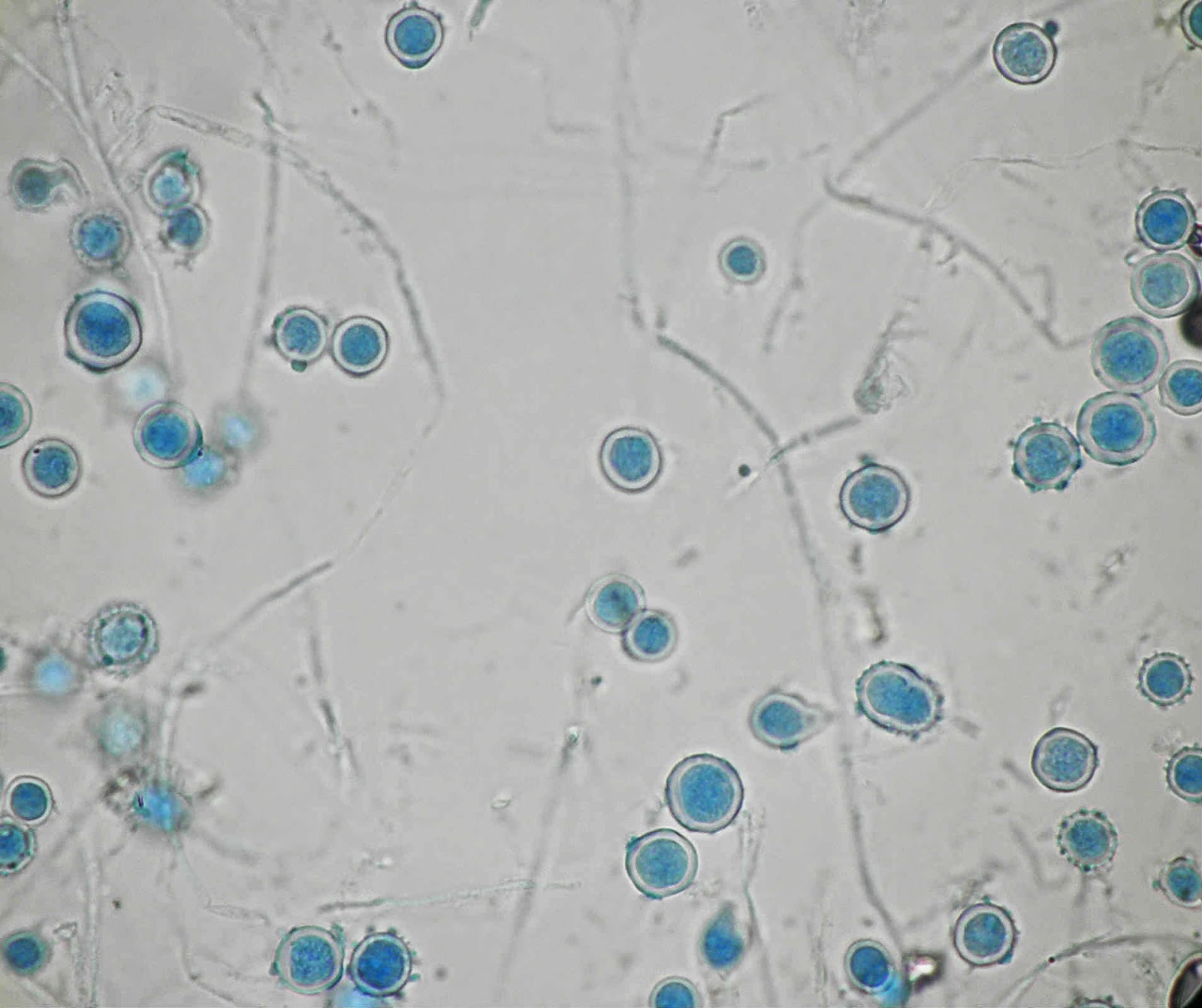 ATLAS MICOLOGIA: CONIDIOBOLUS CORONATUS
