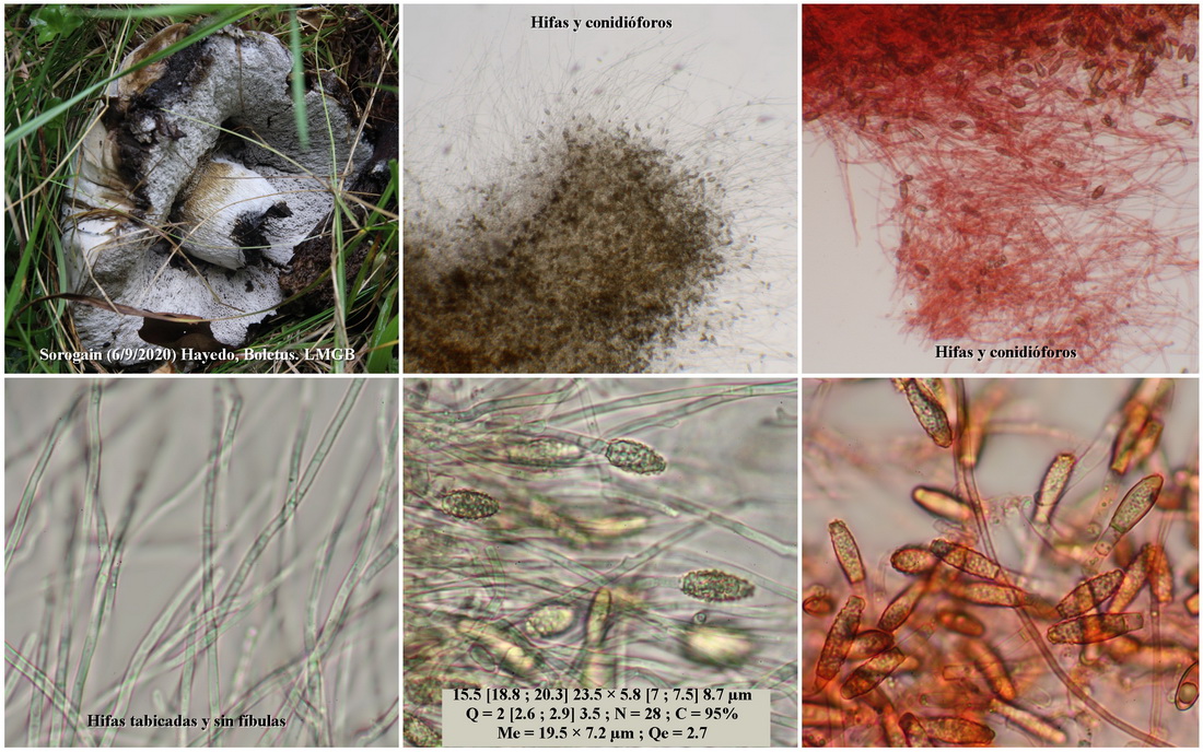 Microscopía de hongos. Vol 2 . D - K: Hypomyces sp.