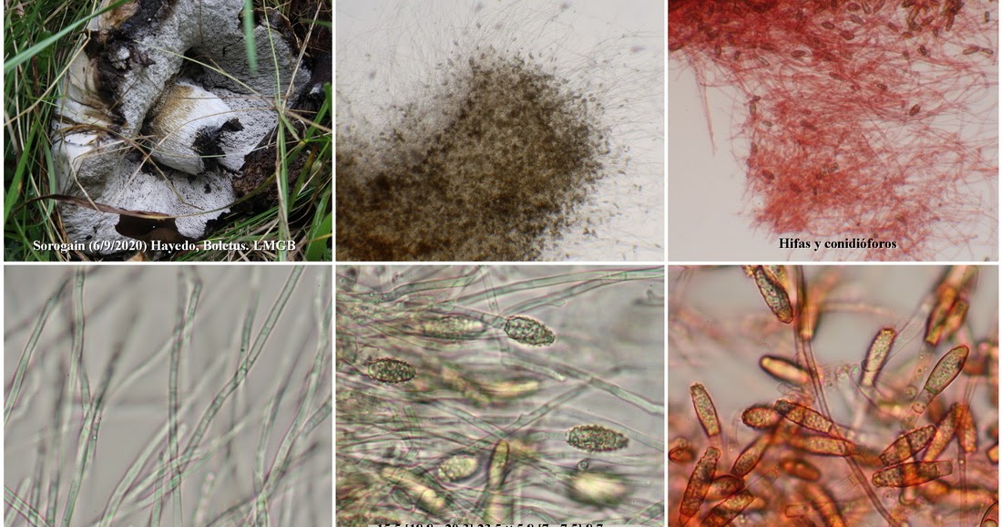 Microscopía de hongos. Vol 2 . D - K: Hypomyces sp.