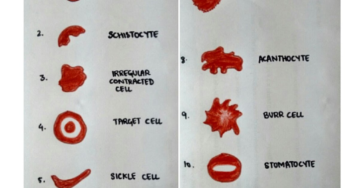 Medicowesome: Poikilocytosis