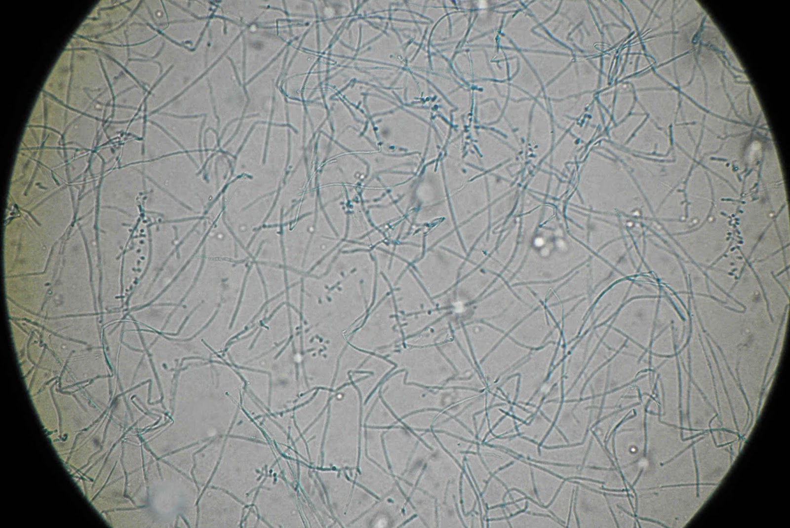 ATLAS MICOLOGIA: TRICHOPHYTON TONSURANS (2)