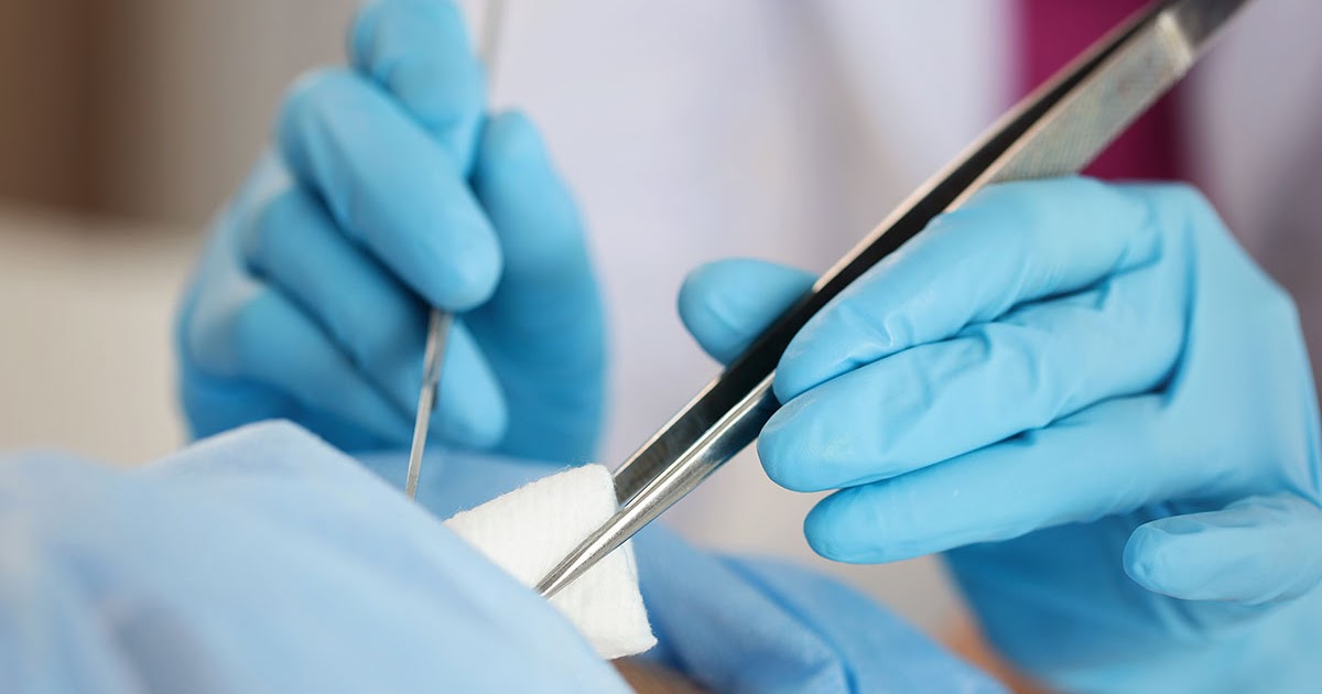 Hip Procedure CPT Code