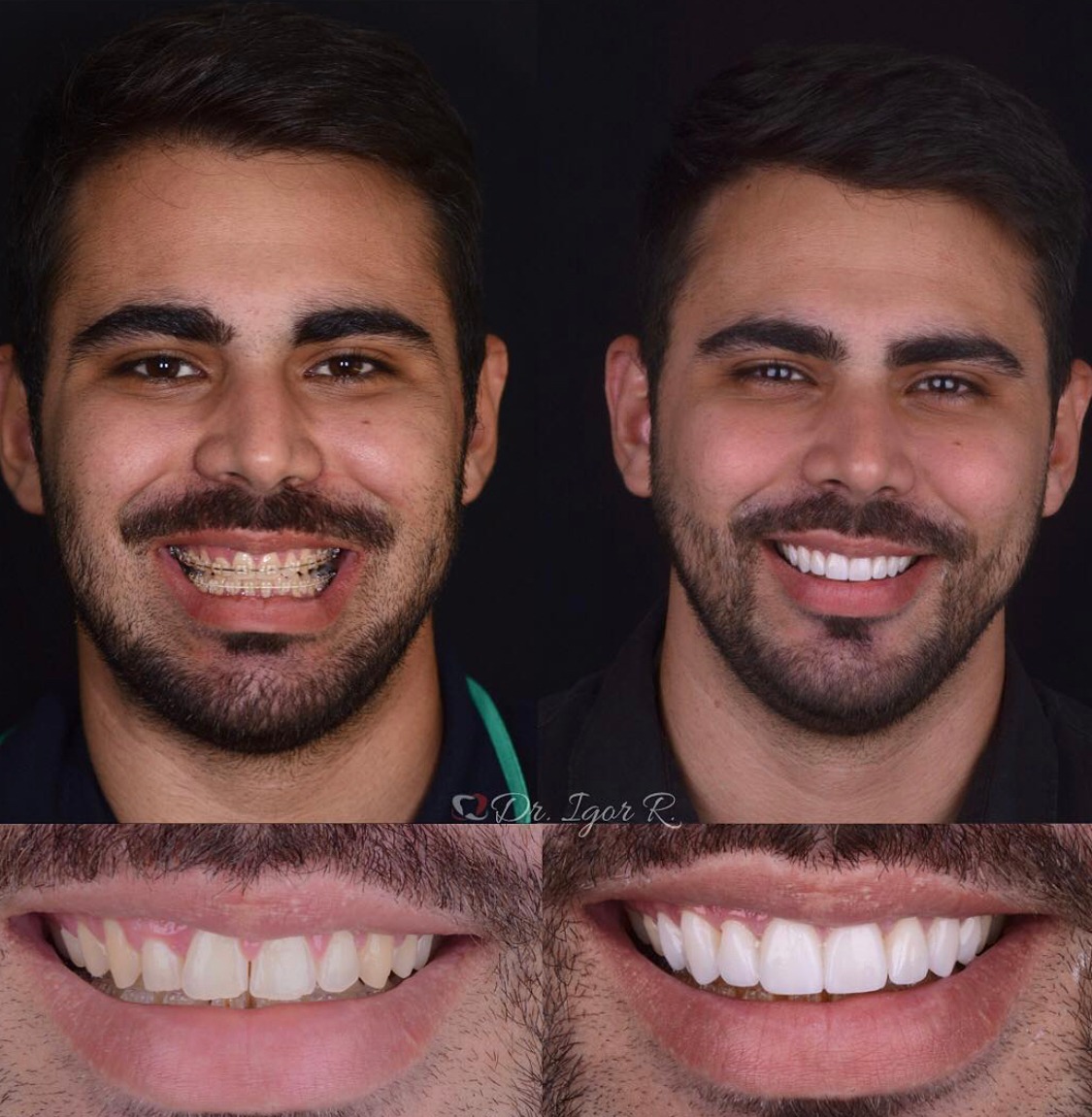 Dr. Igor Ribeiro, conheça as inovações por trás da Odontologia Estética ...