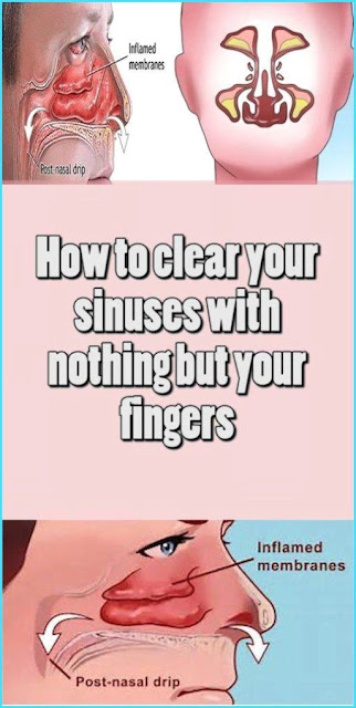 Here’s How to Clear Your Sinuses Quickly In Just Two Steps - medicine health life