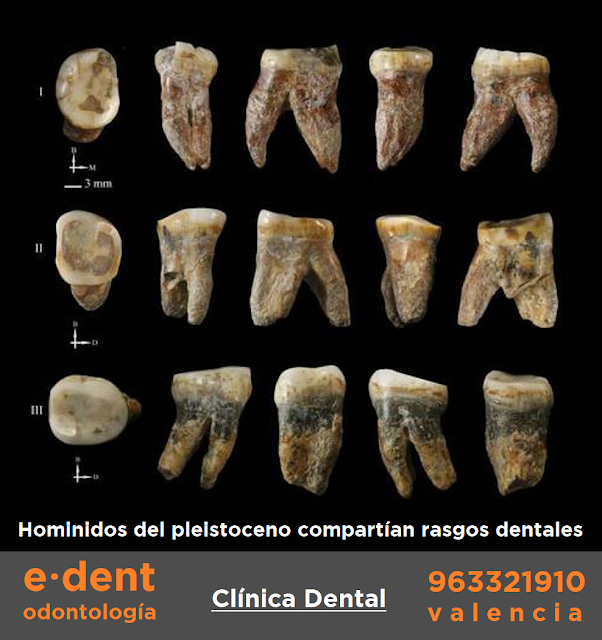e.dent odontología: diciembre 2018