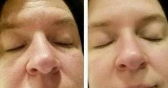 She Washed Her Face With This and Her Daughter Could Not Believe It ...