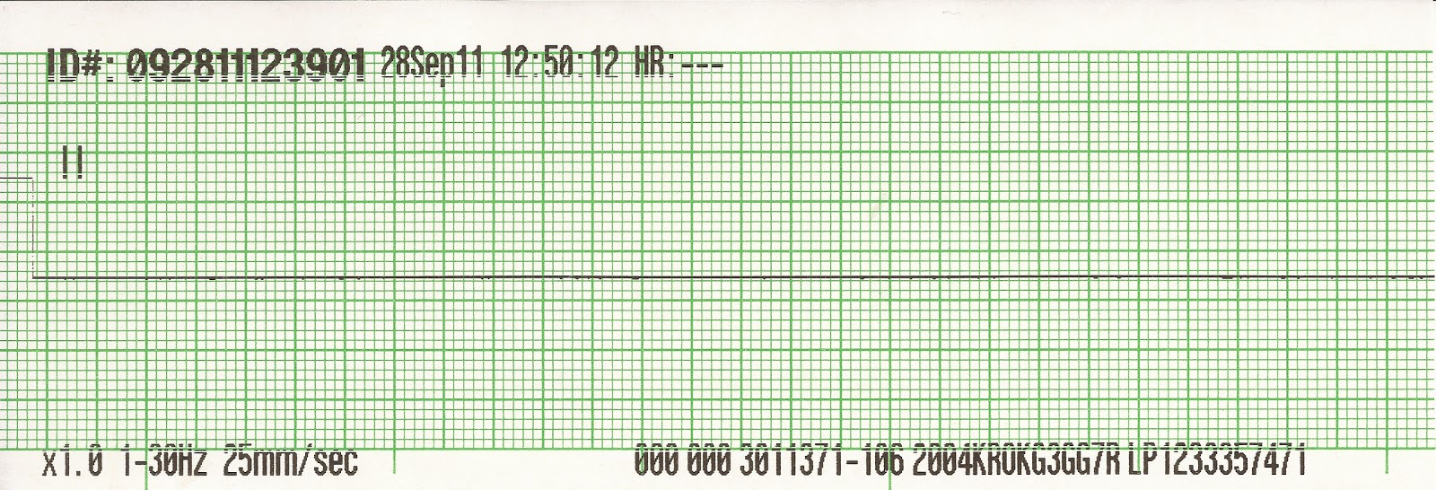 Float Nurse: Pediatric Advance Life Support: Asystole Part 1
