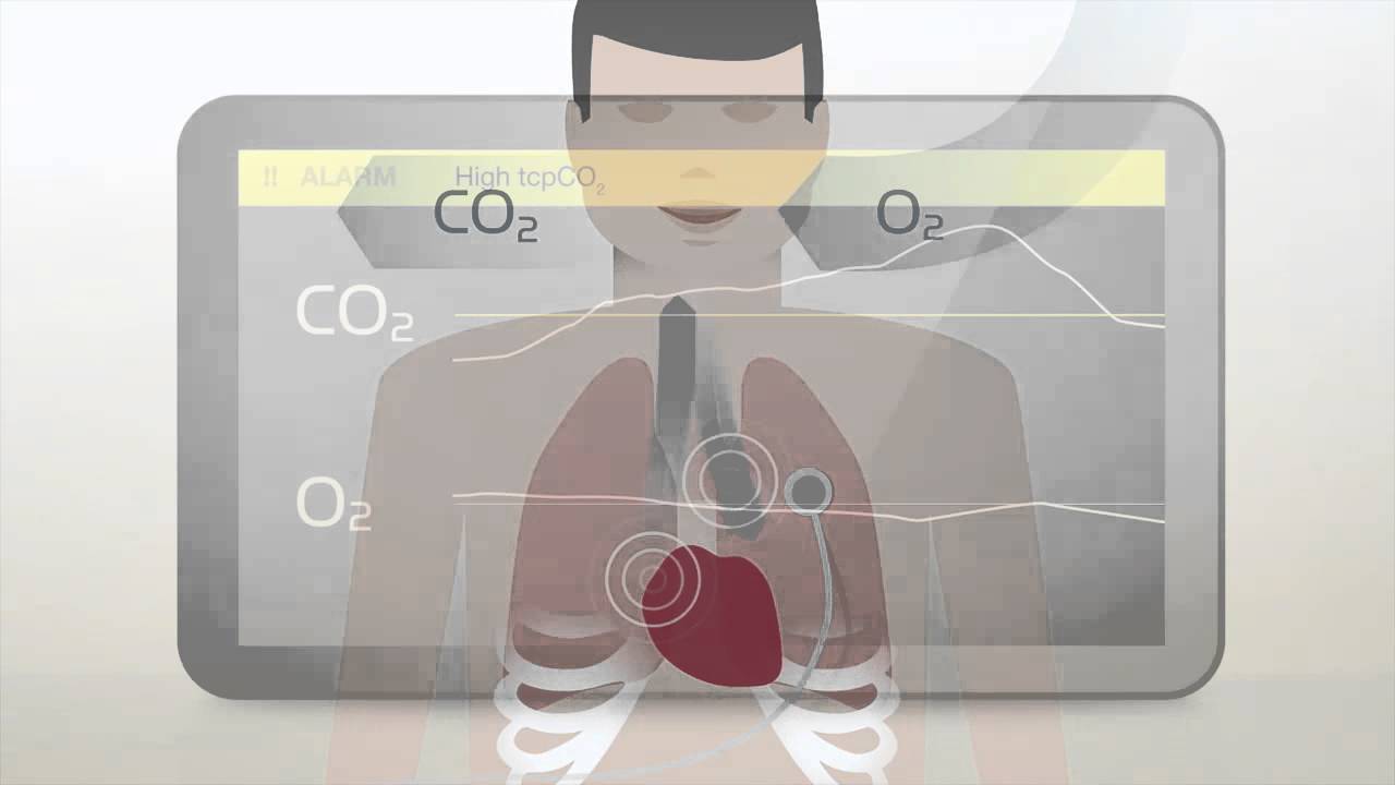 Transcutaneous oxygen measurement