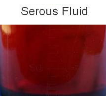 Tomas Stories n' Links: Serous Fluid