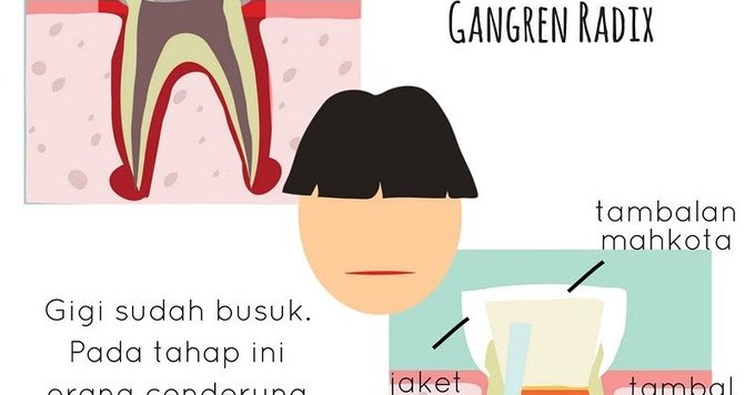 Tes Kesehatan, Gigi, dan Radix - Wamubutabi