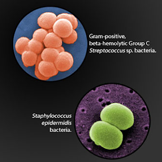 What causes cellulitis ? Is cellulitis contagious ? - IkiDay