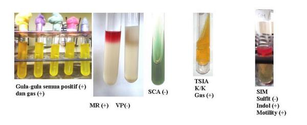 KOMPOSISI MEDIA TES BIOKIMIA DAN MEDIA GULA - GULA - Yazhid Blog