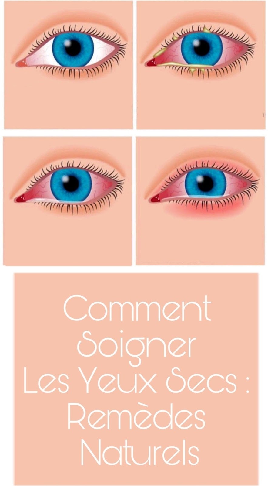 Comment soigner les yeux secs naturellement ~ Nos Conseils de Vie