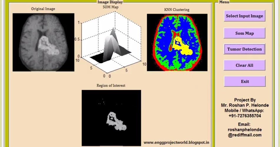 Brain Tumor Detection Using Som Segmentation And K Clustering Matlab Project With Source Code