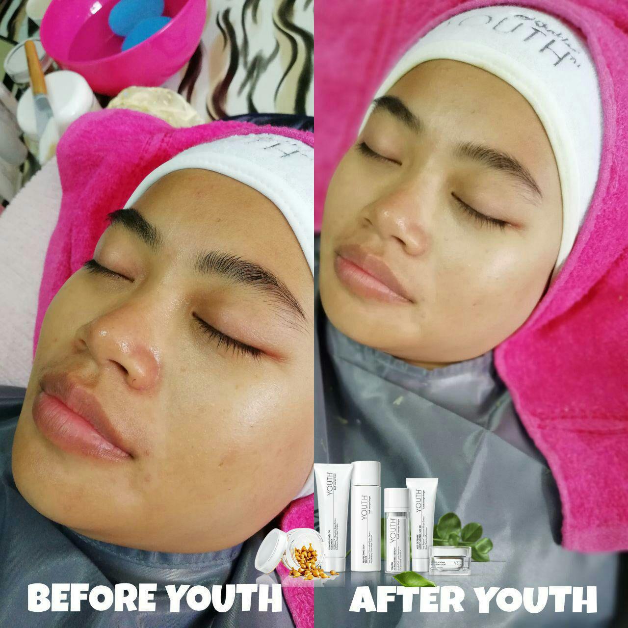 5 Alasan Kenapa Anda Mesti Buat Rawatan Facial