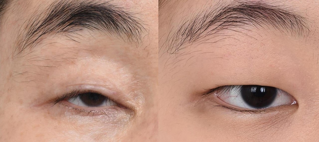 JJPS #The reason why Mongolians have good eyesight