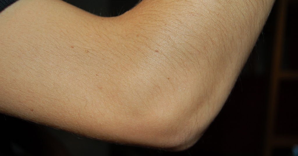 Tutraumatologo.com: EL CODO