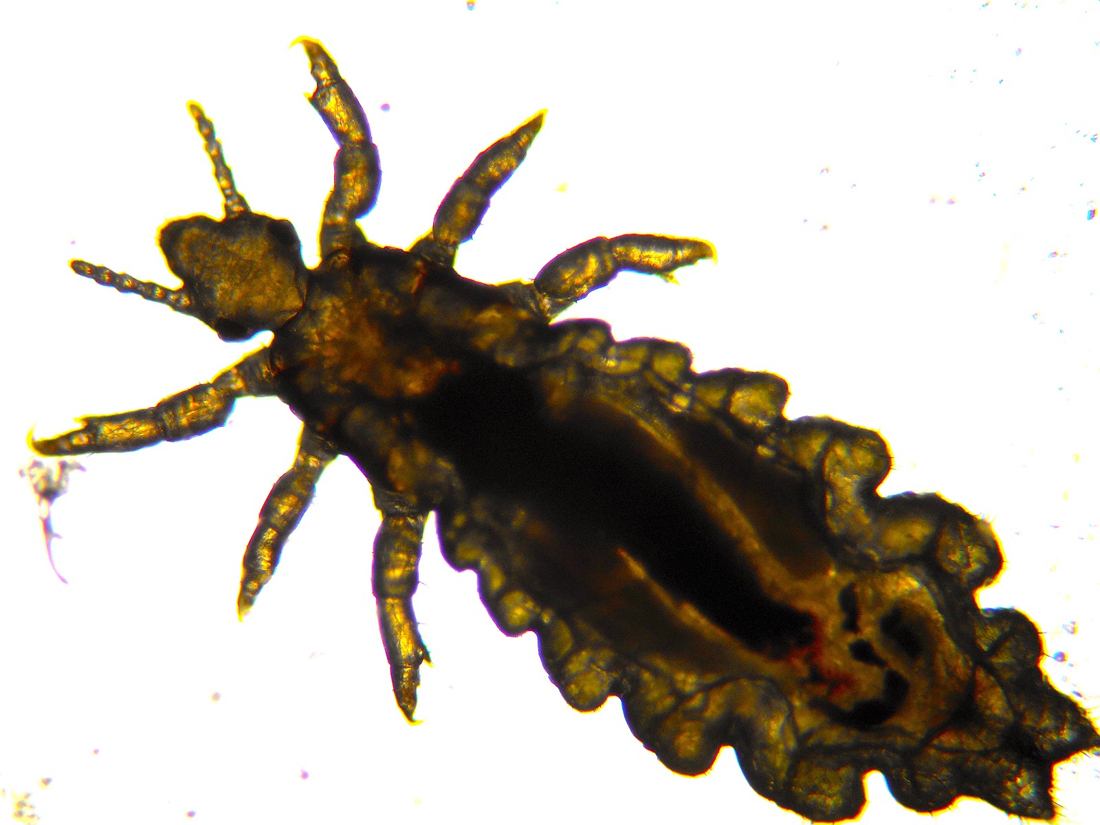 el moderno prometeo: Human Parasites: Lice