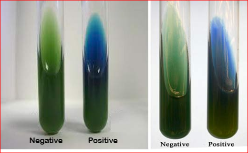 Simmons Citrate Agar biochemistry test for Enterobacteriaceae