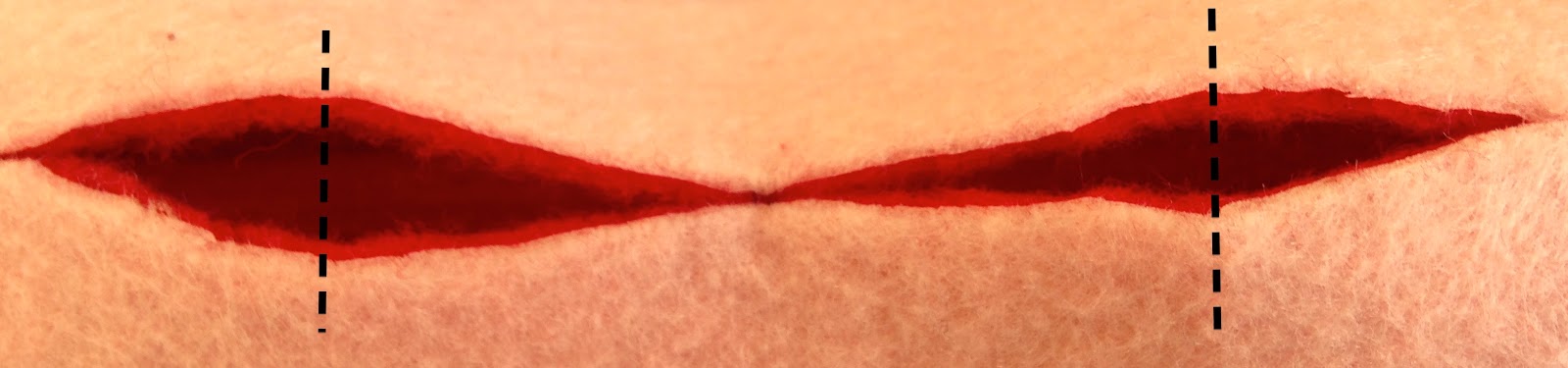 Veterinary Key Points: Closure of Elliptical Incisions in Dogs: The ...