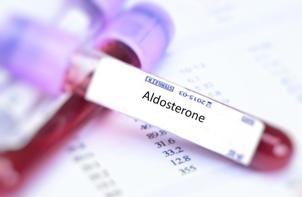 Aldosterone Test | Nurselk.com