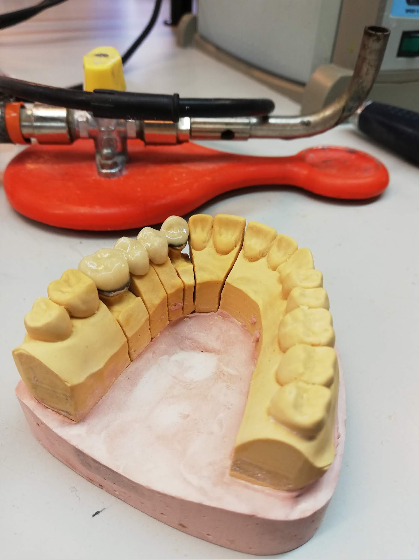 INCRUSTACIÓN EN COMPOSITE