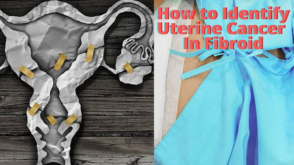 Pelvic Cancer & Fibroid Cells Treatment - DGS Health