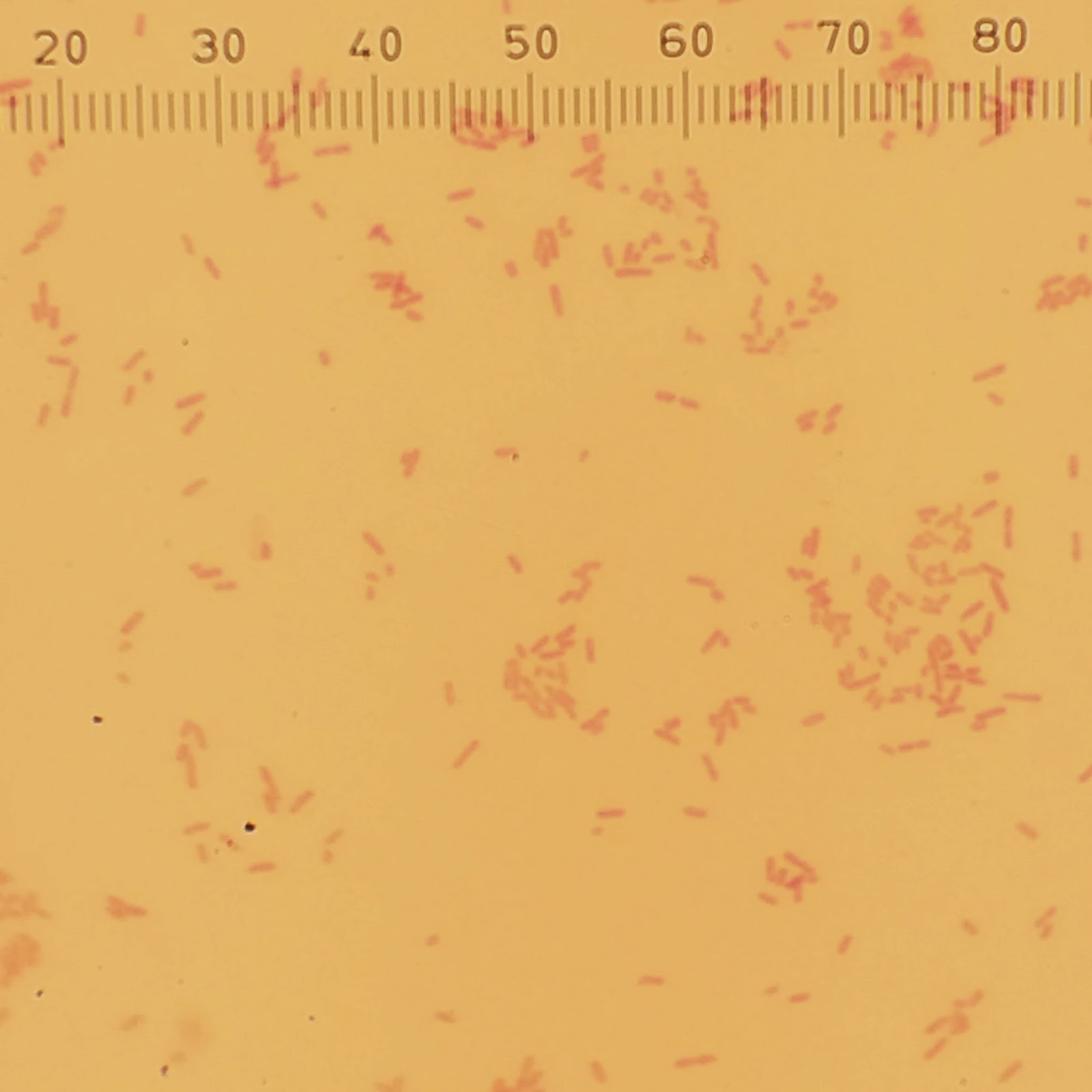 My Microbe Assignment: E.coli