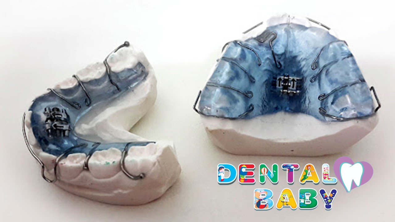 Clinica Dental Baby: A ORTOPEDIA FUNCIONAL DOS MAXILARES