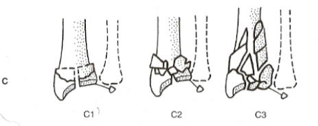 Fracturas de Muñeca y Mano