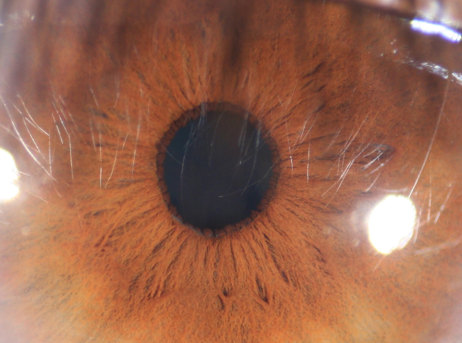 Modern & Multidimensional Iridology: Important iris Signs at IPB, Pupil ...