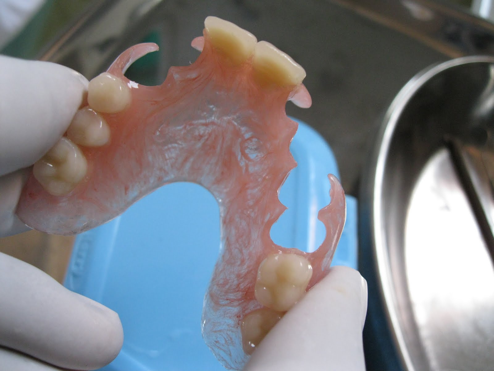 DENTO CARE DENTAL CLINICS: FLEXIBLE DENTURES as IMMEDIATE DENTURE
