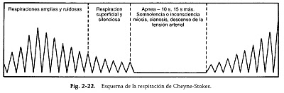 Medicina: Respiración de Cheyne-Stokes