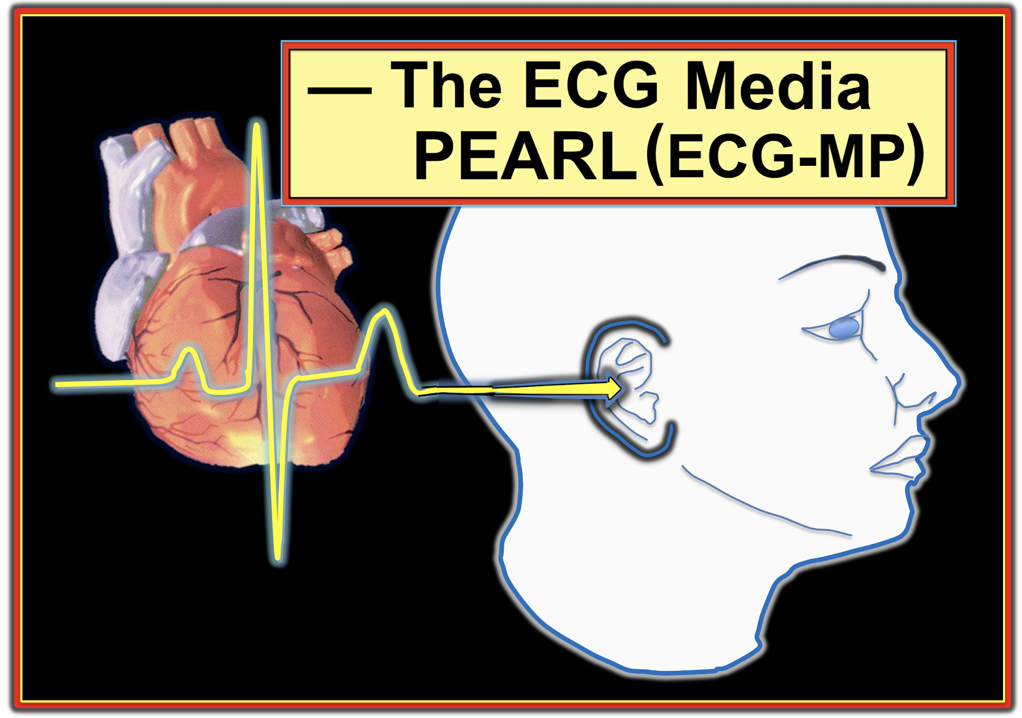 ECG Interpretation: ECG Blog #225 — ECG Media PEARL (5-16-2021)